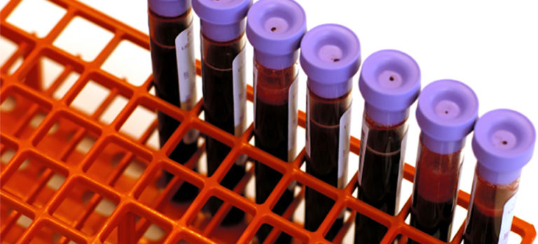 SPECIMEN STABILITY CONSIDERATIONS DURING FLOW CYTOMETRY ASSAY ...