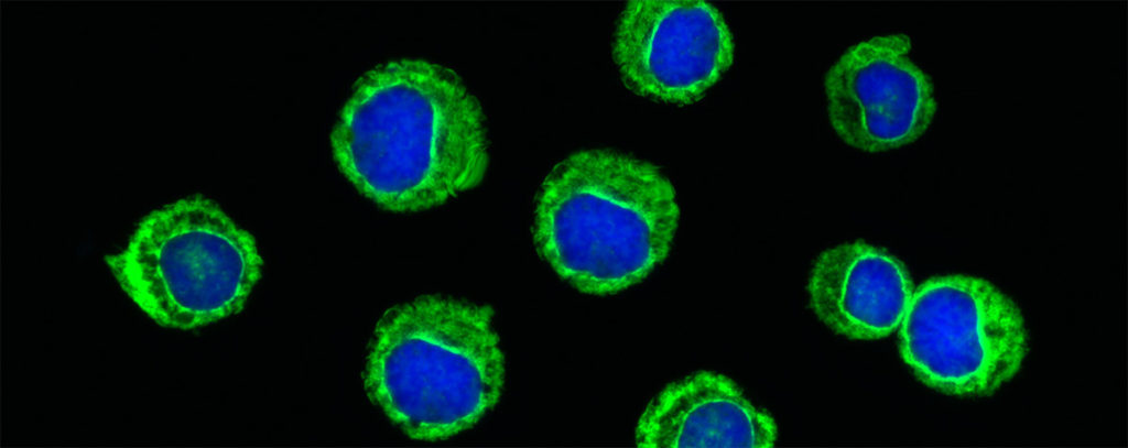 Comparison of Different Fix/Permeabilization Buffers for use in Flow ...